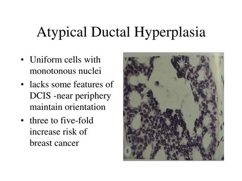 Ppt Breast Clinical Correlation Powerpoint Presentation Free