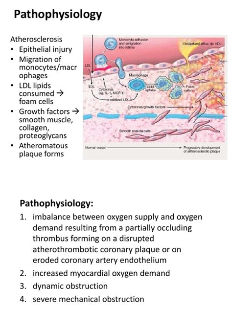 Nstemi Pathophysiology Pdf
