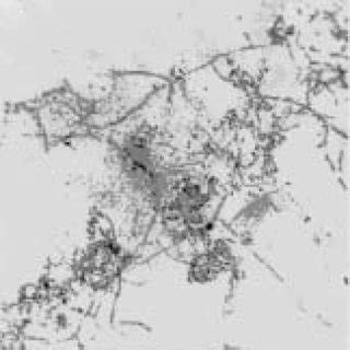 Microphotograph Of Micromonospora Purpurea M110 Substrate Mycelium