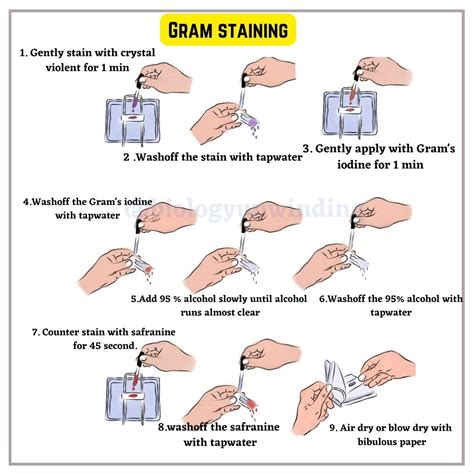 Gram Staining History Application Principle Procedure