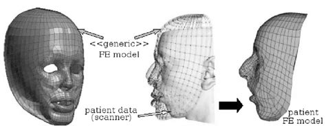 The Mesh Matching Algorithm In A Maxillofacial Simulation Download