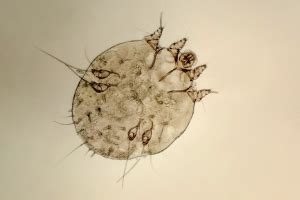 Scabies