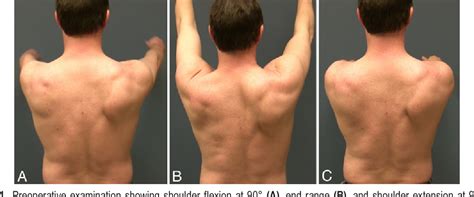 What Does The T12 Nerve Control