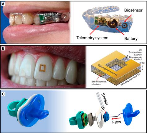 Salivary Glucose Sensors A A Wearable Cellulose Acetate Coated