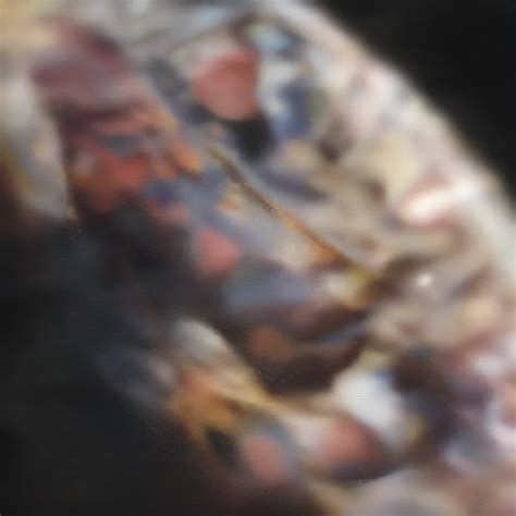 Comprehensive Review Of Diuretics And Their Uses