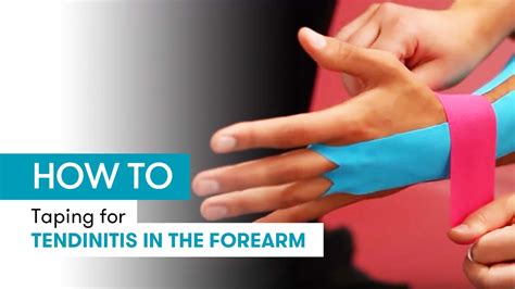 Forearm Tendinitis Taping Instructions With Video