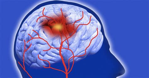 Wilderness Wanderings Managing Mitochondrial Disease While Loving The