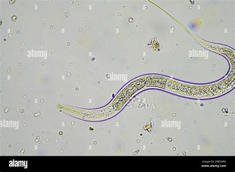 Protozoan Cell Under Microscope Protozoan Cell Under Microscope