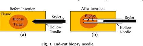 Figure 1 From Hollow Needle Tissue Insertion Force Model Semantic Scholar