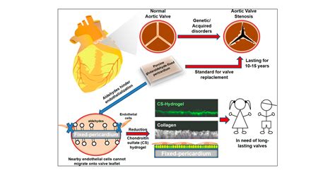 Optimizing Glutaraldehyde Fixed Tissue Heart Valves With Chondroitin