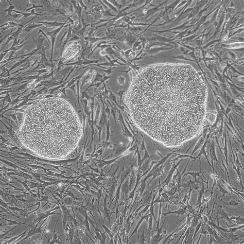Stem Cell Bank Ucla Bscrc