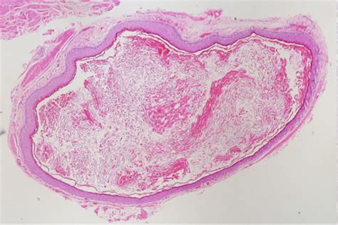 Derm Block 2 Histology Flashcards Quizlet