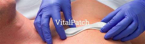 Vital Patch Button Vitalconnect