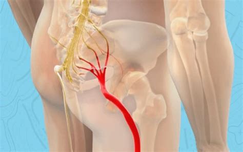 Say Goodbye To Sciatica Nerve Pain In 5 Minutes New Secret