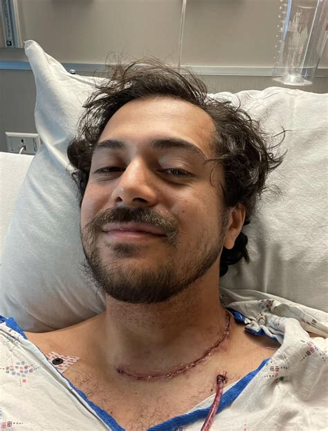 Full Thyroidectomy64 Lymph Nodes Removed Rthyroidcancer