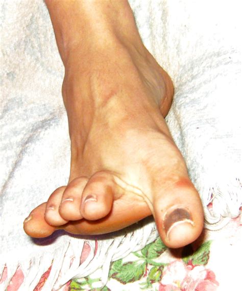 Marta S Feet Foot Model Spreads Curls Her Flexible Toes Porn Pictures Xxx Photos Sex Images