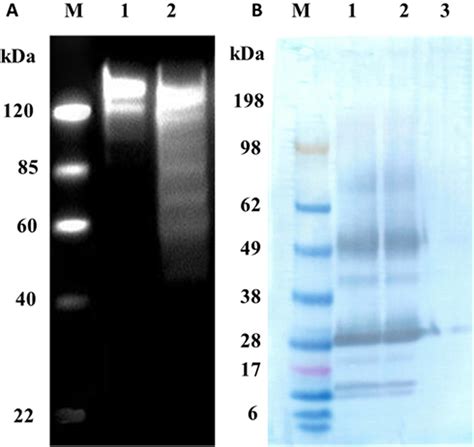 Western Blot Analysis Using Anti His Antibody A Western Blot Image Of