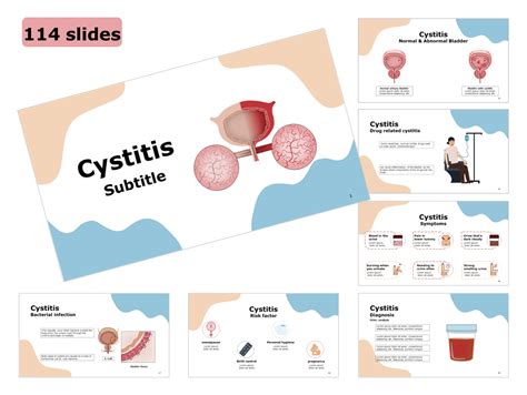 Cystitis Powerpoint Template Rxslides The Largest Online Store For Medical Powerpoint Templates