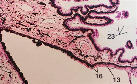 Diagram Of Ciliary Process Quizlet Diagram Of Ciliary Process Quizlet