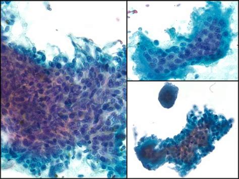 June 2010 The International Academy Of Cytology