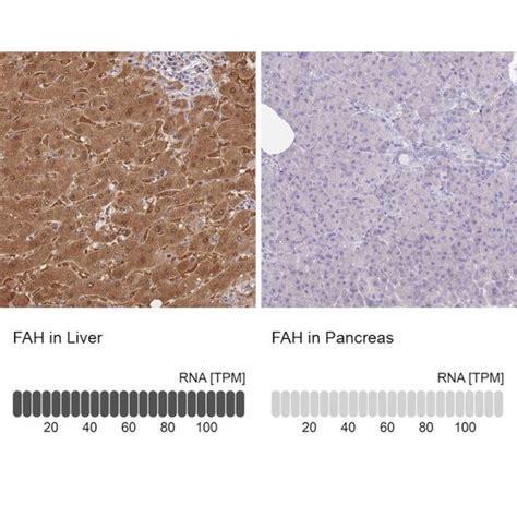Fah Polyclonal Antibody Invitrogen Pa5 83705