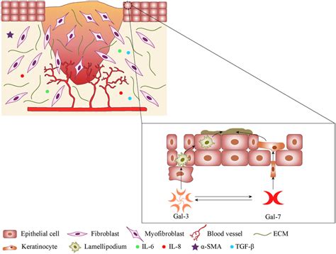 Shows The Stages Of Re Epithelialisation During Wound Healing
