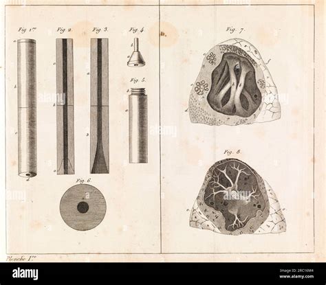 First Stethoscope And Lungs With Tuberculosis 19th Century