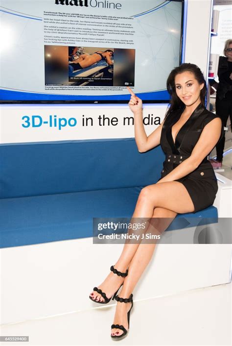 Chloe Goodman Flaunts New Bum Lift Results On The 3d Lipo Stand At