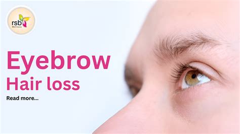 Eyebrow Hair Loss Rsb Wellness