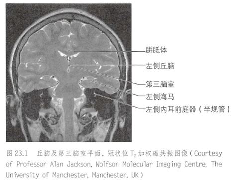 【神外解剖学】丘脑多图详解 脑医汇