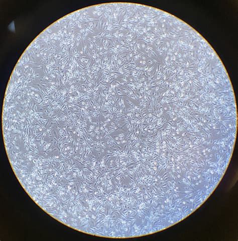 Why My Murine Bmdm Die After L929 Sn Removal Researchgate