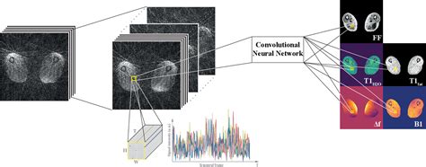 Magnetic Resonance Fingerprinting Models Code And Papers Catalyzex