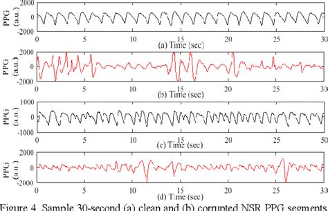 Figure 4 From Smartwatch Based Atrial Fibrillation Detection From Photoplethysmography Signals