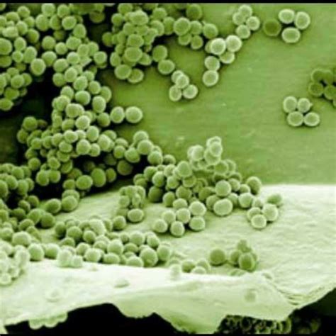 Pdf Bacterial Adhesion An Introduction