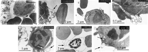 Ultrastructure Of The Erythrocyte Rosette Binding Part Observed By