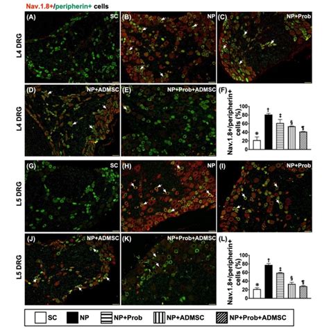Cellular Expressions Of Co Localizations Between Nav18 And Peripherin