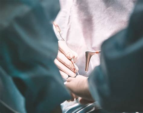 Genital Surgery Surat Elegance Clinic