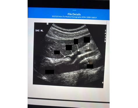 Aorta Ultrasound Labeling 1 — Printable Worksheet