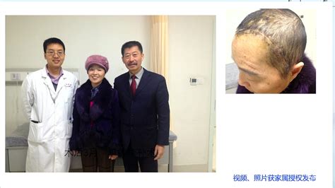 冯军峰教授：额叶脑挫裂伤救治：实施与反思 脑医汇