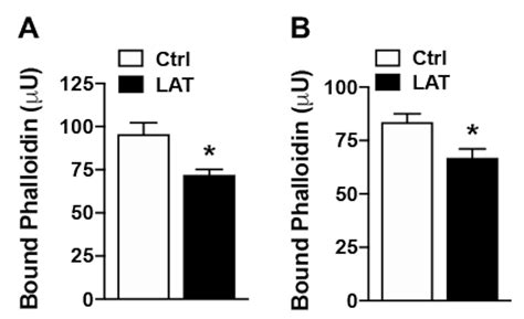 Video A Time Efficient Fluorescence Spectroscopy Based Assay For Evaluating Actin
