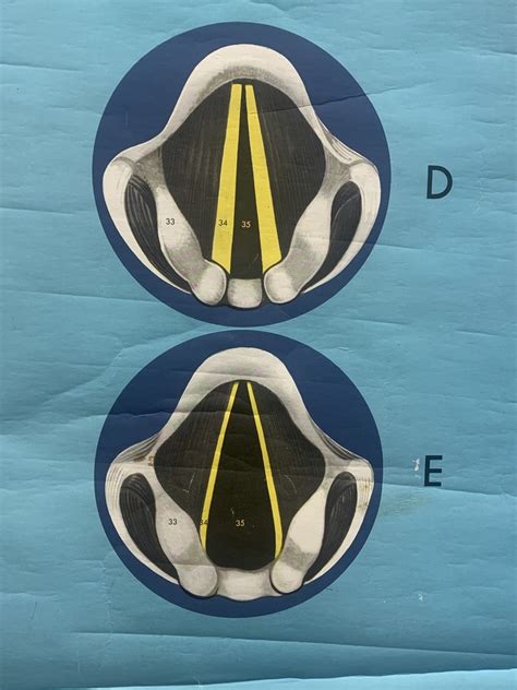 Vocal Chords Diagram Quizlet