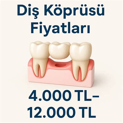 Diş Köprüsü Fiyatları 2025 Ne Kadar Ödemeniz Gerekir Redent Klinik