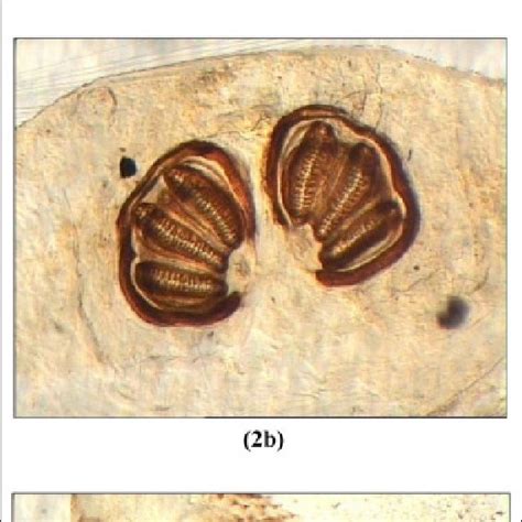 Larval Mounts A Anterior Spiracle B Posterior Spiracular Plate C
