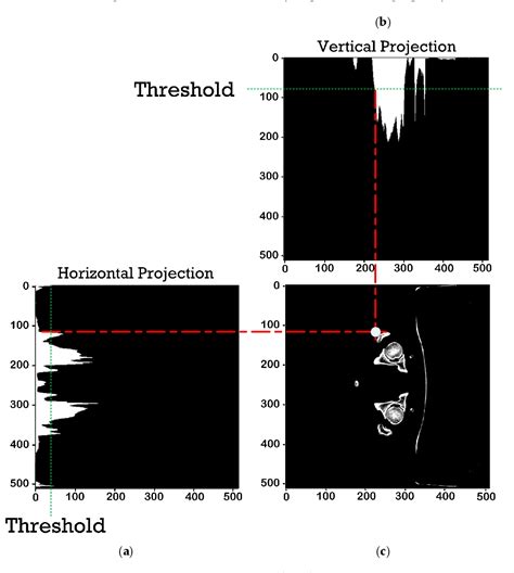 Figure 4 From Enhanced Deep Learning Based Automatic Left Femur Segmentation Scheme With