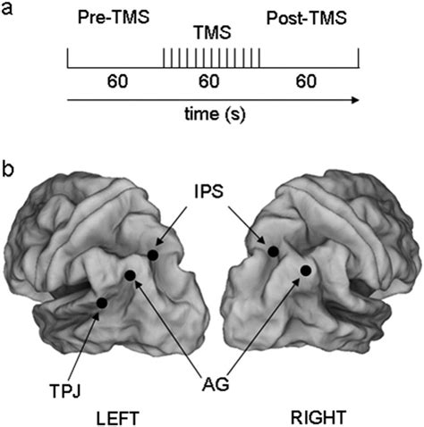 Experimental Design A Temporal Sequence For Each Rtms Stimulation