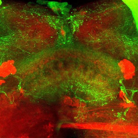 Foxp In The Fan Shape Body