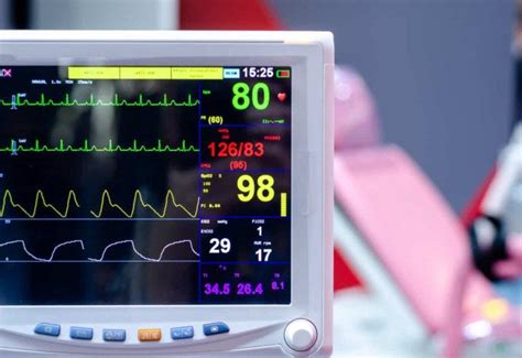 How To Improve Ecg Rhythm Recognition Using A Dcnn By Auriga Medium