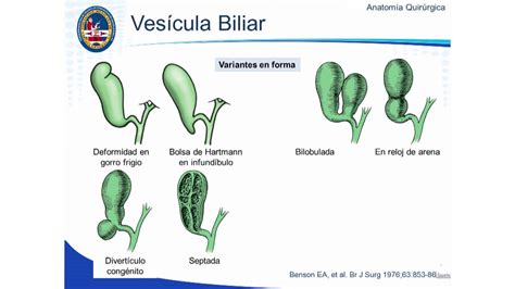 Vesícula Biliar En Bolsa De Hartmann