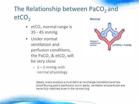 Capnography In The Pacu Theory And Clinical Applications Ppt Download