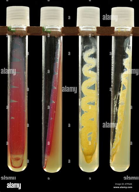Agar Plate Vs Agar Slant At Tasha Hyman Blog